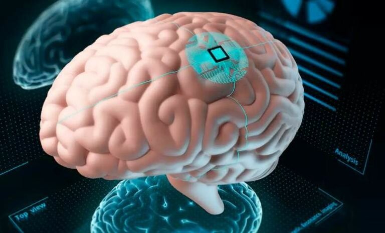Brain Implant Breakthrough: Empowering Paralyzed Patients to ...